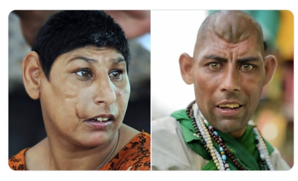 Cousin Marriages and Genetic Disorders in Pakistan: What You Need to ...